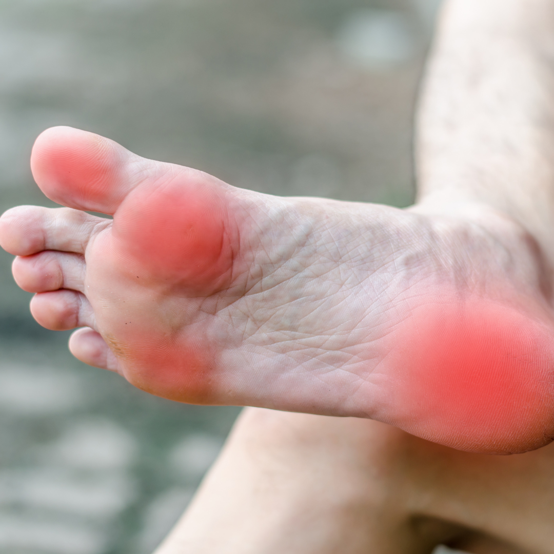 How to Prevent Common Foot Problems - New Jersey Podiatric Physicians ...