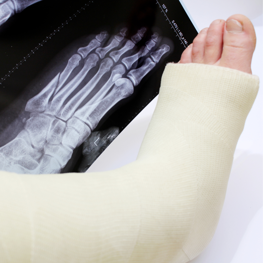 Common Recurring Foot Injuries - New Jersey Podiatric Physicians ...