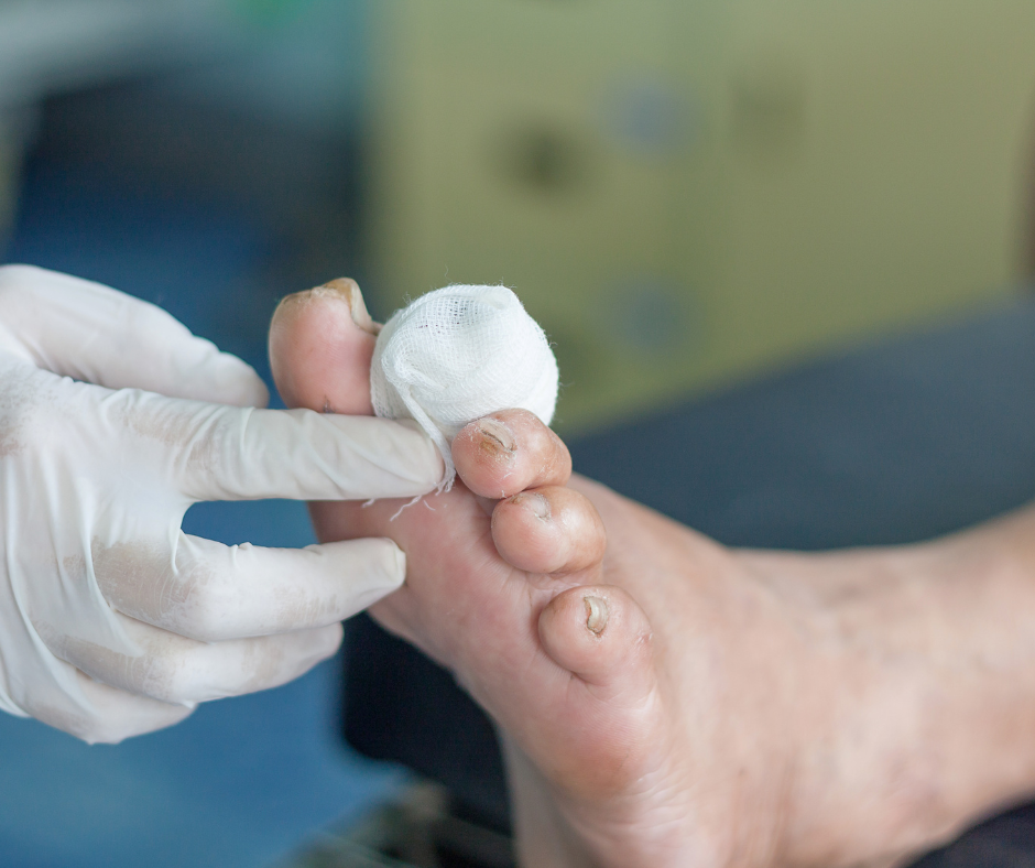 Wisdom for Wound Care - Nexus Foot & Ankle - New Jersey Podiatric ...